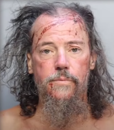 Suspect in attack on 82-year-old used bottle, hurled anti-LGBTQ slurs ...